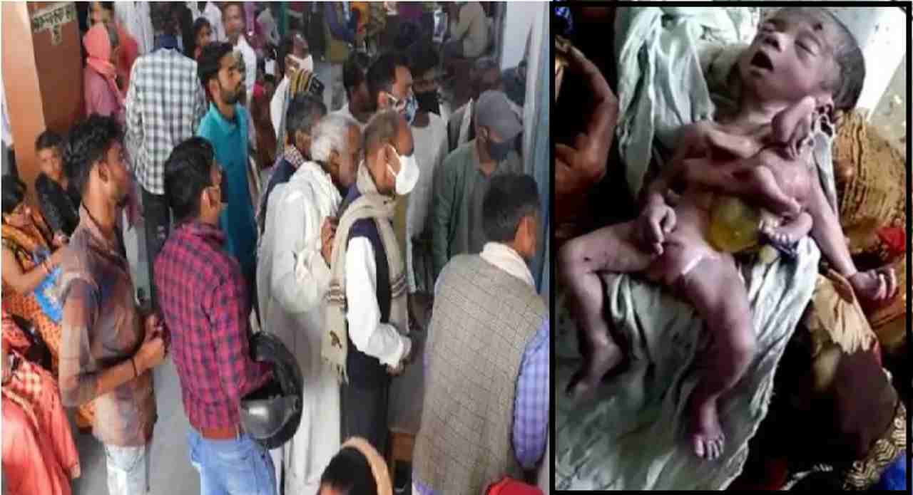 Madhya Pradesh : A child with four hands, four legs and four ears was ...